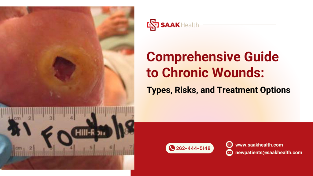 Comprehensive Guide to Chronic Wounds: Types & Treatments