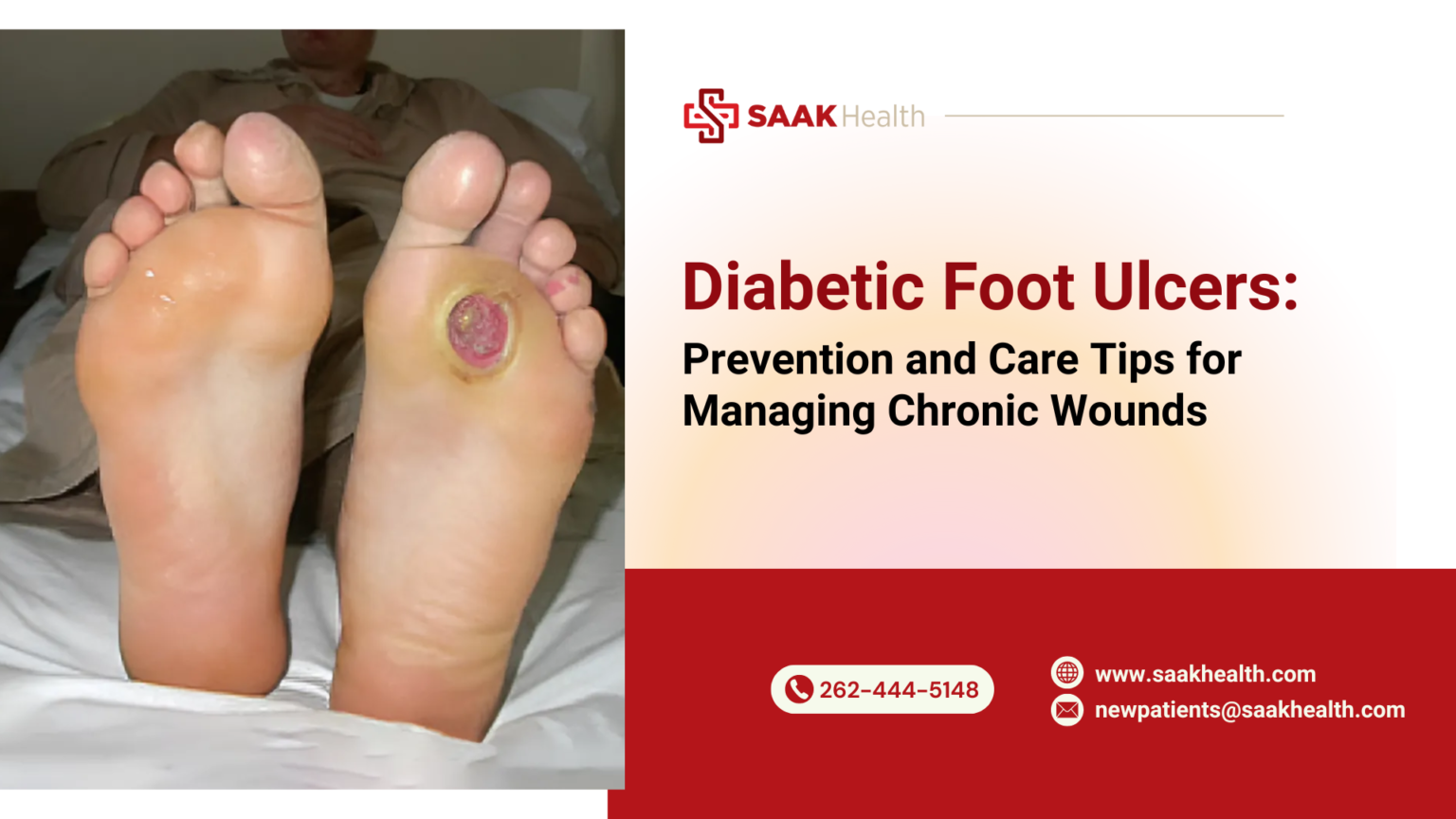 Diabetic Foot Ulcers: Prevention & Care Tips for Chronic Wounds