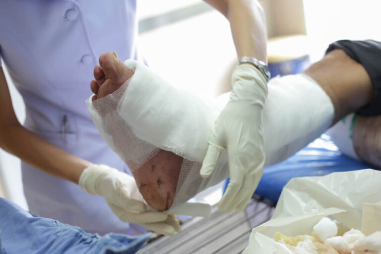 Understanding Chronic Wounds: Types, Causes & Treatments