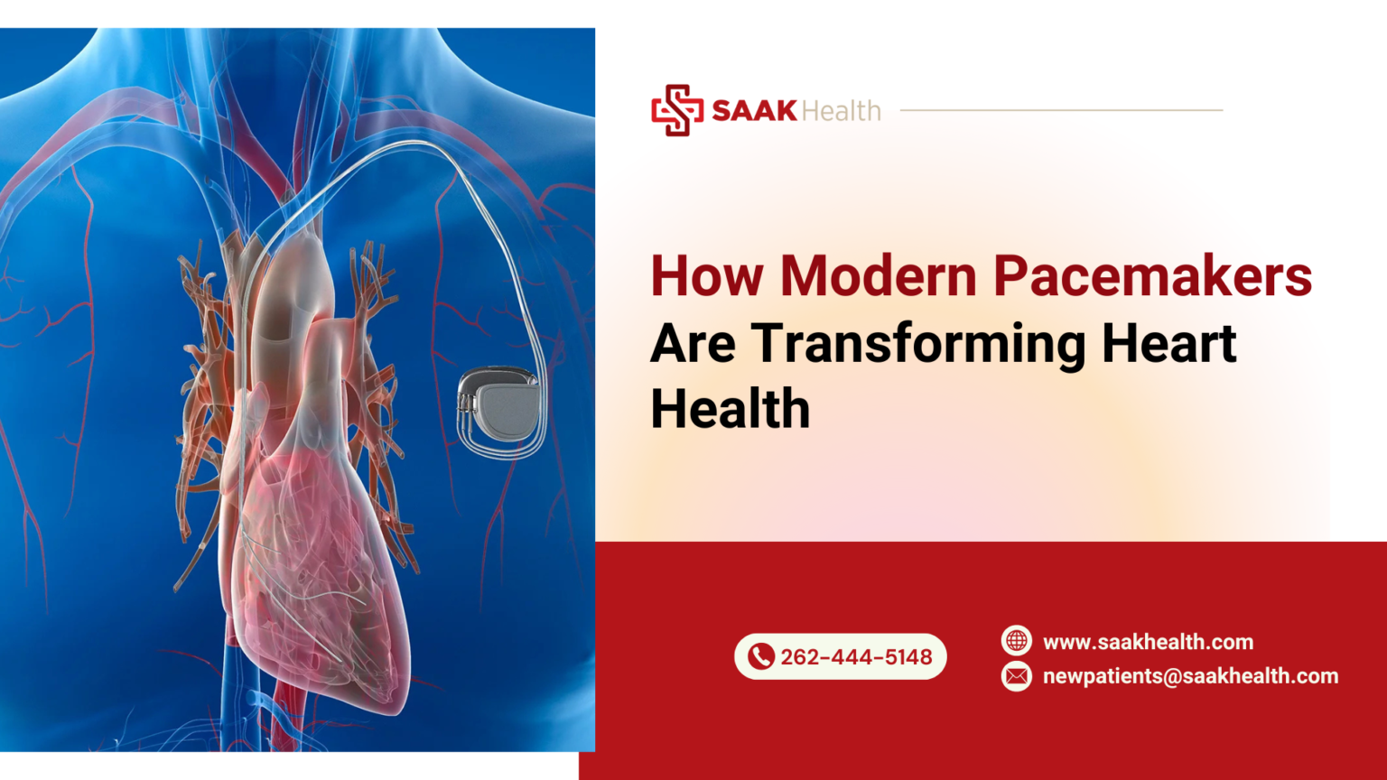 How Pacemakers Are Revolutionizing Heart Care